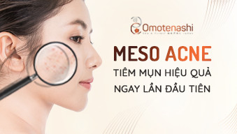 MESO ACNES- GIẢI PHÁP AN TOÀN HIỆU QUẢ CHO DA MỤN